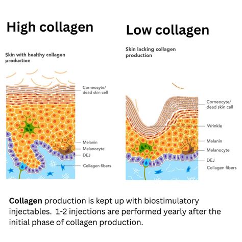 Biostimulator Injections Complete 2023 Guide Dr Davin Lim