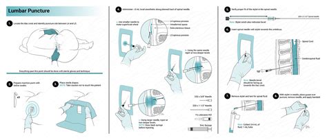 Digital Nerve Block Ami Meeting 2021