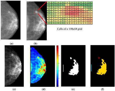 Mammographic Segmentation Using Wavecluster