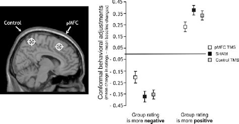 Figure 1 From Downregulation Of The Posterior Medial Frontal Cortex