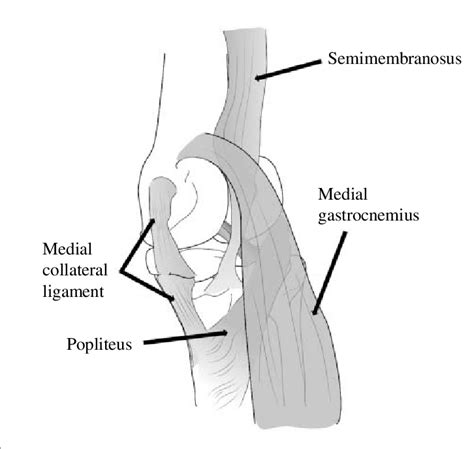 Plane For Access To Posteromedial Aspect Of Proximal Tibia Download Scientific Diagram