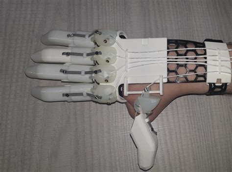 luke cox s prosthetic hand prototype staffordshireuniversity