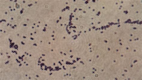 آشنایی بیشتر با استافیلوکوکوس ساپروفیتیکوس مجله پل ایده‌آل پارس