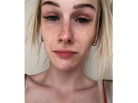 Love How The Weather Is Triggering My Freckles🥰 Scrolller