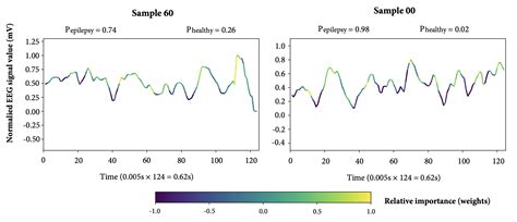 Learning Robust Global Local Representation From Eeg For Neural