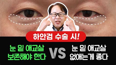 애교살 그대로 두면 주름 생기고 더 처집니다 하안검 수술 애교살 더이상 고민하지 마세요 Youtube