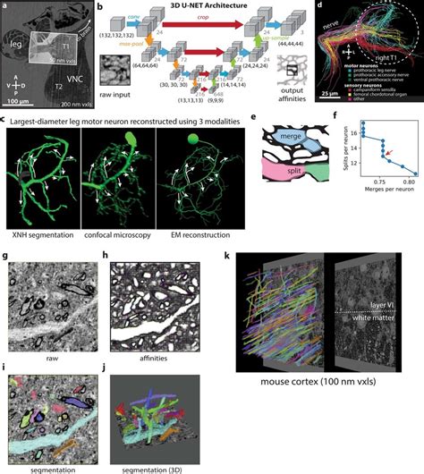 Automated Segmentation Of Neuronal Morphologies Using Convolutional Download Scientific Diagram