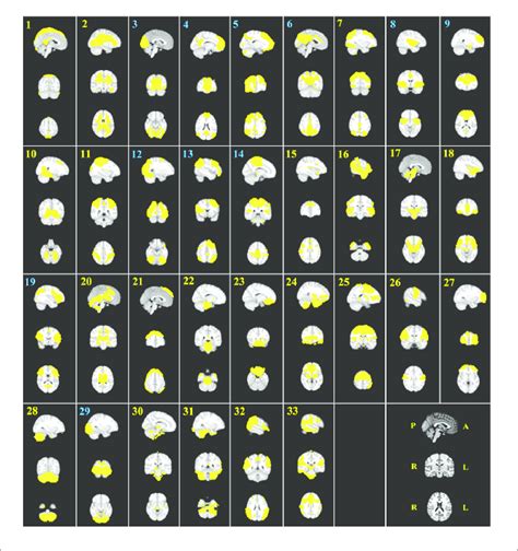 The 33 Automatically Generated Ics By Group Ica All Ics Were Download Scientific Diagram
