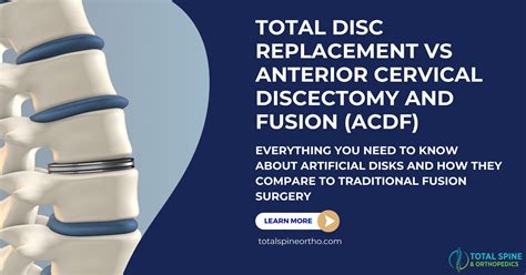 Total Disc Replacement Vs Acdf Fusion Surgery Total Spine