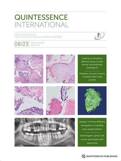 Retrospective Analysis Of Three Different Xenografts In Maxillary Sinus Augmentation Histologic