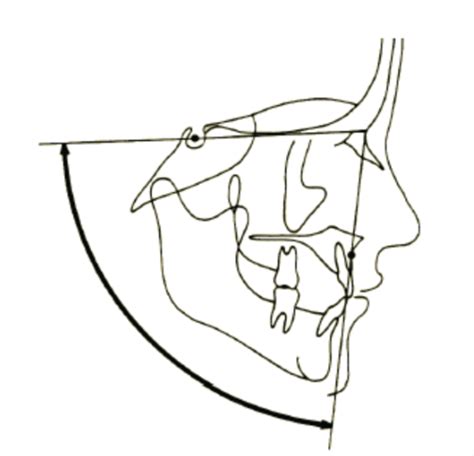 2 7 Ceph Interpretation Tracing Of Flashcards Quizlet