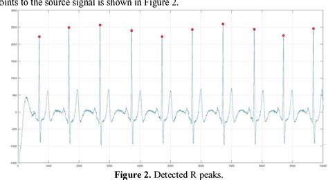 Figure 1 From Myocardial Infarction Detection Using Wavelet Analysis Of Ecg Signal Semantic