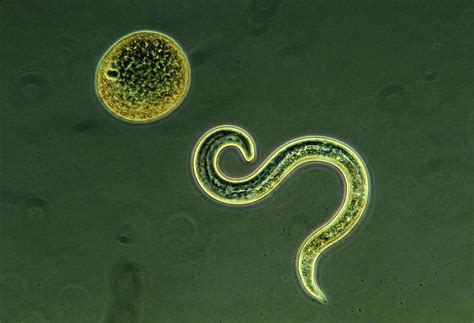 Toxocara Canis Larvae