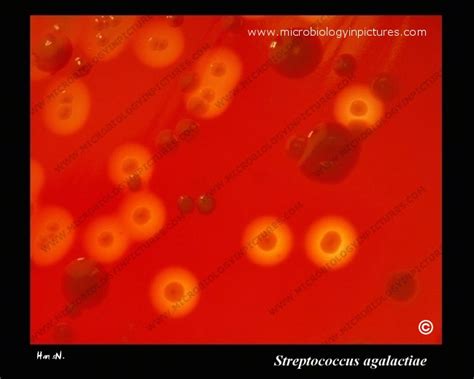 Streptococcus Agalactiae In A Mixed Culture With Nonhemolytic Colonies