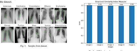 Figure 3 From A Novel Deep Learning Assisted Svd Based Method For Medical Image Watermarking