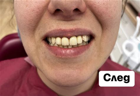 Д р Вергиния Борисова Дентален и естетичен кабинет Troyan