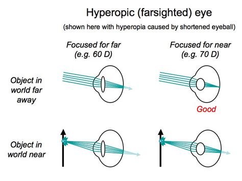 Perception Lecture Notes The Eye