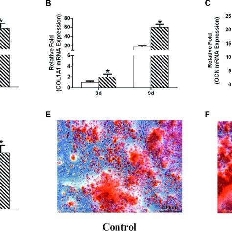 The Gene Expression Levels Of Alp Col1a1 Ocn And Runx2 In The