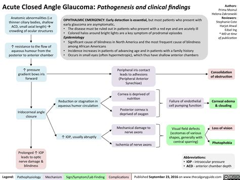 Acute Angle Closure Glaucoma Review Canadiem