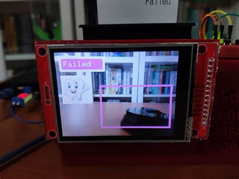 Ai Driven Dental Cast Model Classifier W Edge Impulse Artofit