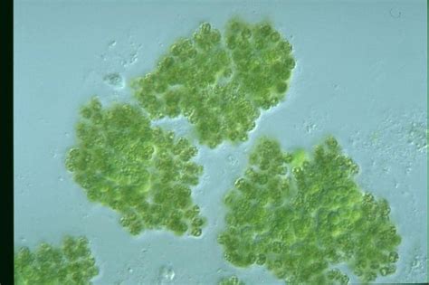Microcystis Sp Biology Algae World Map