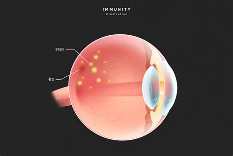 The Comprehensive Research Of Lutein Capsule Lyphar Offers Free Samples