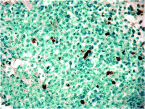 Tunel Staining Of Ehrlich Ascites Tumor Cells Grown In Balb C Mice Download Scientific Diagram