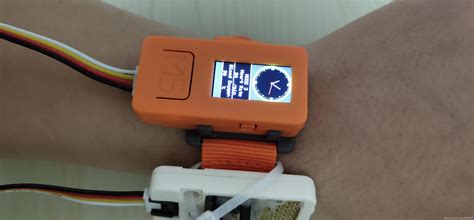 基于esp32的智能家庭健康系统esp32养老系统 Csdn博客