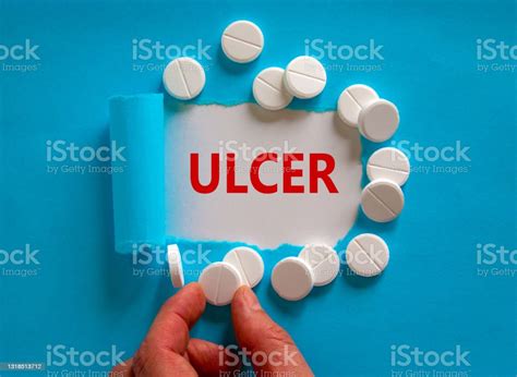 위 궤 양 기호 단어 궤양 찢어진 된 파란색 종이 뒤에 나타나는 흰색 알 약 의사의 손 의료 및 위 궤 양 개념 공간을 복사합니다 배경 주제에 대한 스톡 사진 및 기타