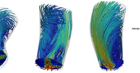 Fuid Structure Interaction In Pulsatile Flow