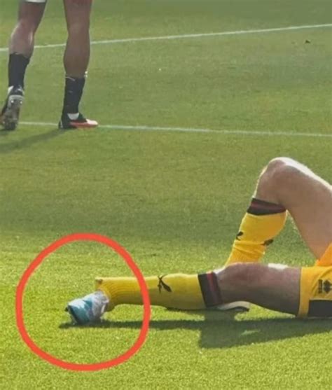 Warning Graphic Content Chris Basham Football Chat One Team In