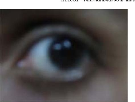 Figure 1 From An Effective Method For Iris Recognition Based On
