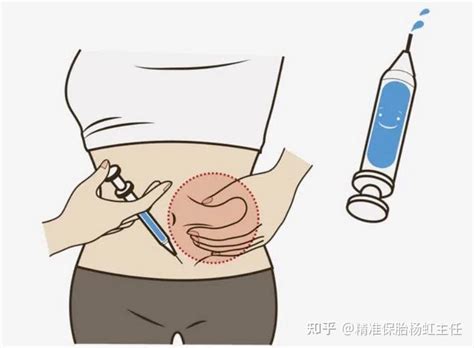 低分子肝素的使用及注意事项 知乎