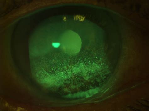 Kps Centre Ophtalmologique à Vic