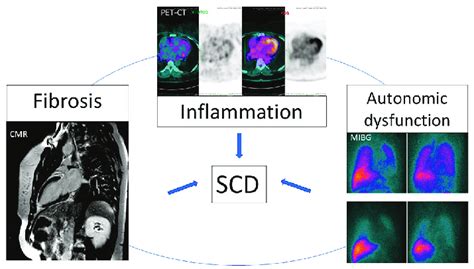 New Imaging Modalities Can Detect Abnormalities Involved In The Genesis Download Scientific