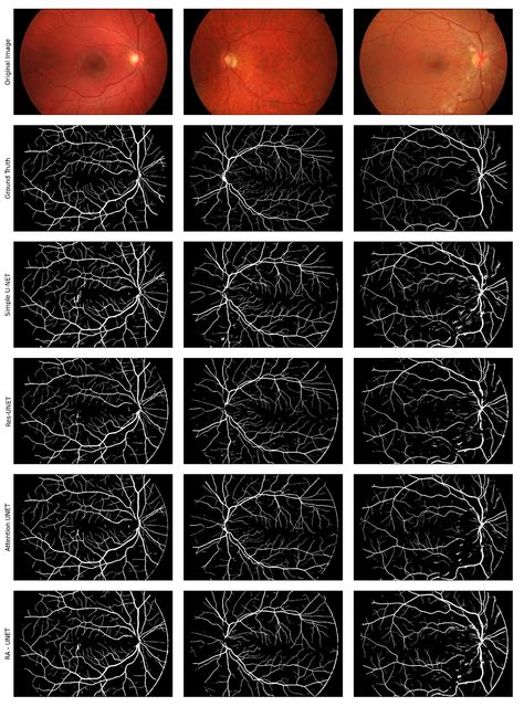 Github Arkanivasarkarretinal Vessel Segmentation Using Variants Of