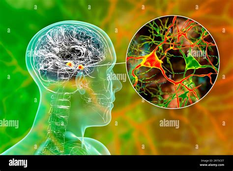 Brain Parts Amygdala