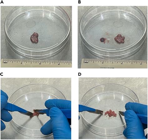 Mincing Of Human Head And Neck Tumor Tissue A Initial Tumor Sample Download Scientific