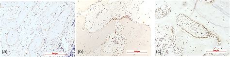Runt‐related Transcription Factor 2 Runx2 Immunohistochemistry For