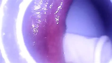 Die Porno Videos In Der Kategorie Endoskop Xhamster