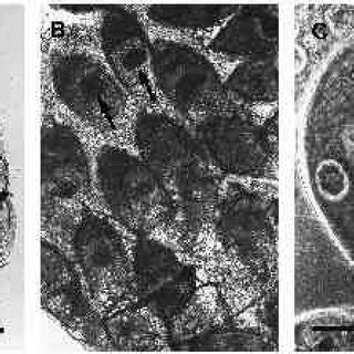 Suppression Of The Sexual Transformation Of 2X 2A O T U Germ Cells Download Scientific