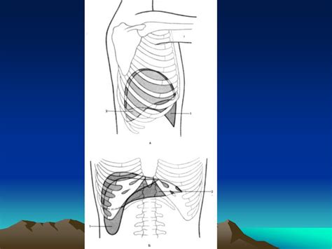 Клиническая анатомия брюшной полости презентация онлайн