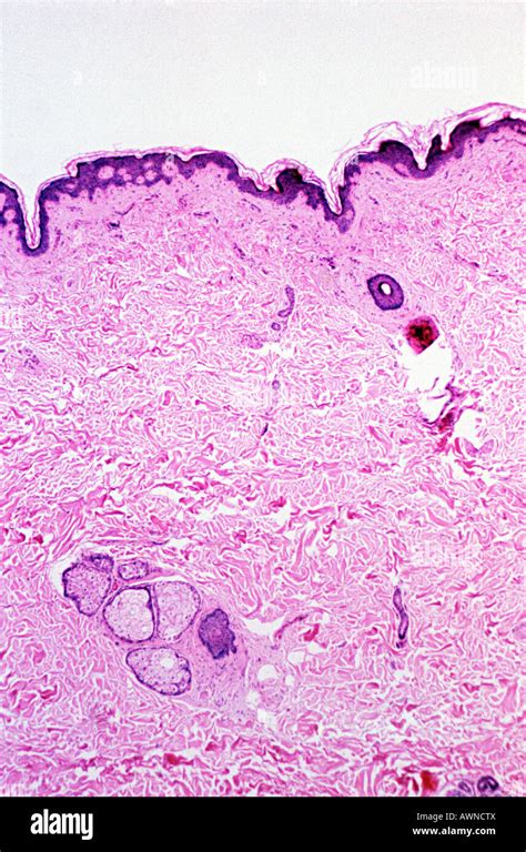 Human Skin Cell Under Microscope