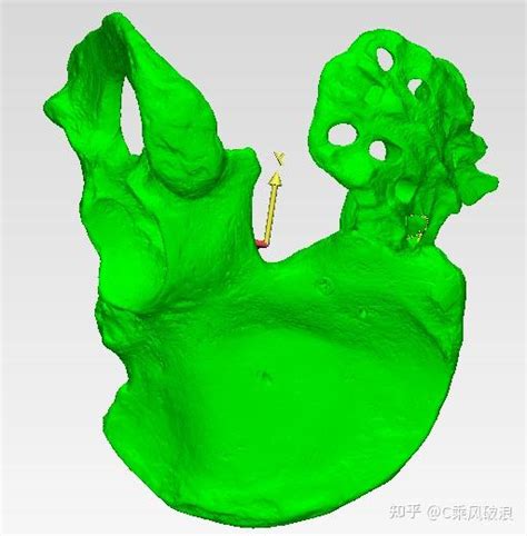 三维重建人体各器官结构模型 知乎