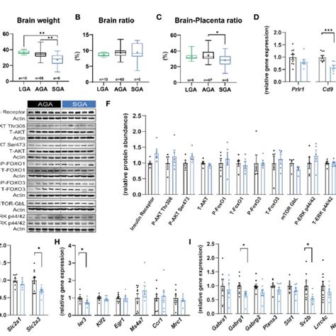 Small For Gestational Age And Its Impact On Fetal Brain A Brain Download Scientific Diagram