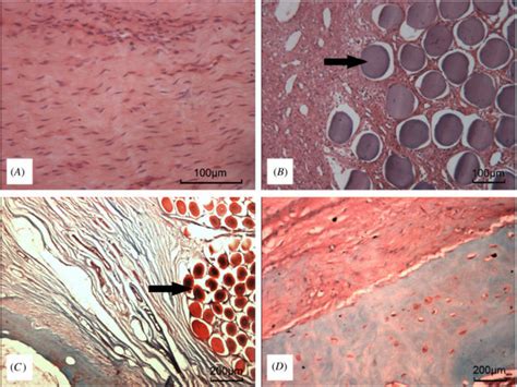 Histology Of Regenerated Ligament He And Ligamentbone Junction