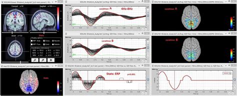 Statistics Negative T Value Discussions Brainstorm