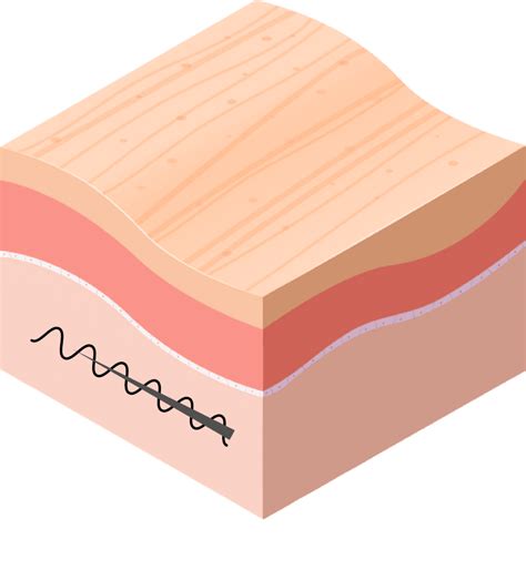 Pdo Mono Threads In Melbourne Plasma Therapy