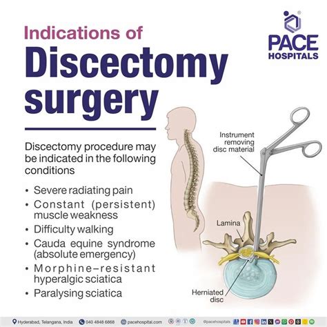 Discectomy In Hyderabad India Best Diskectomy Surgery