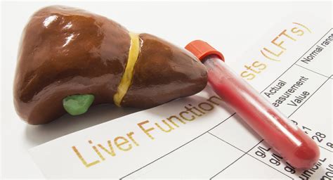 Liver Function Tests What Do They Mean Liver Doctor